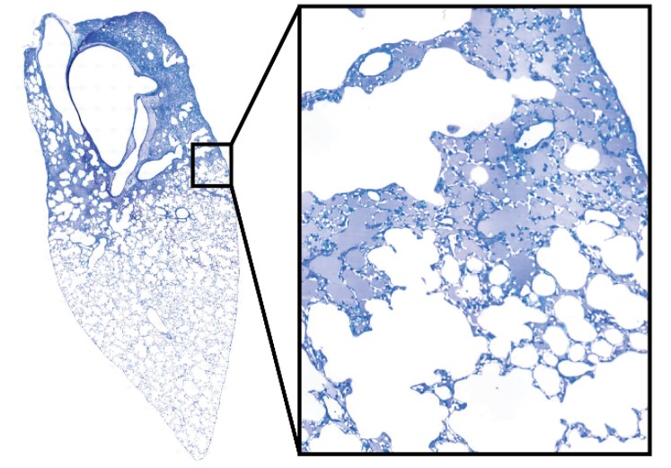Smith Pulmonary and Biomechanics Laboratory – College of Engineering ...